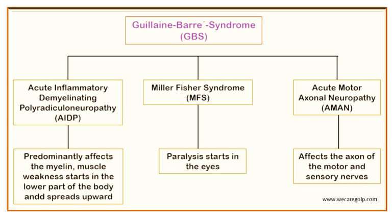 Guillain-Barré syndrome (GBS) - We Care