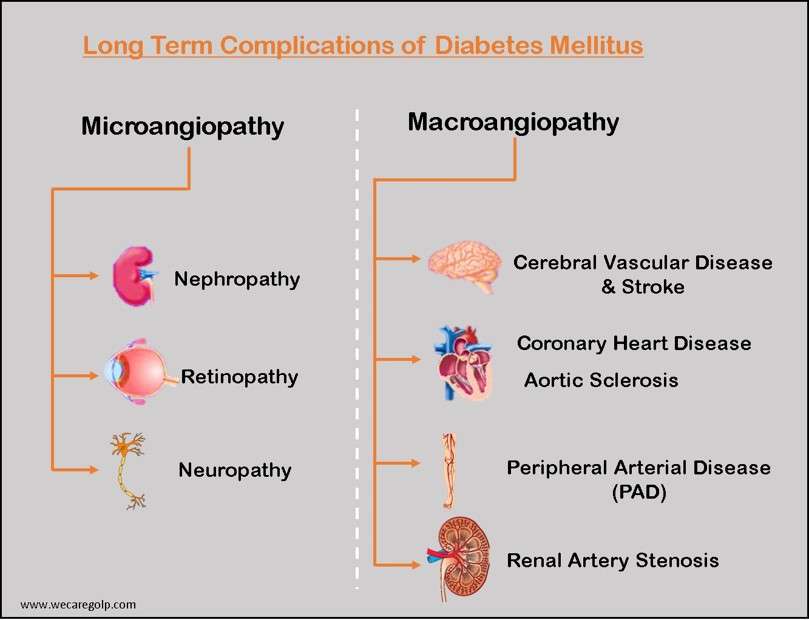 Diabetes Mellitus: Types, Causes, Symptoms, Treatment - We Care
